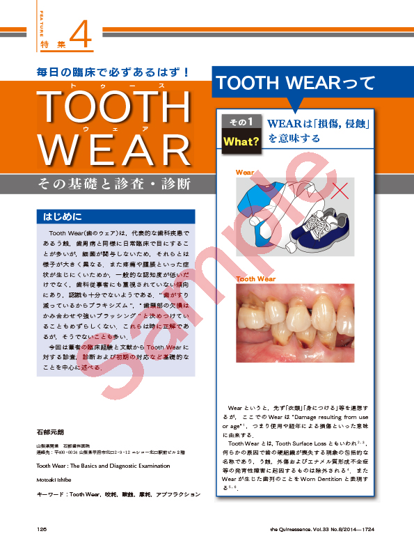 旬の話題 毎日の臨床で必ずあるはず！Tooth Wear その基礎と診査・診断 - クインテッセンス出版