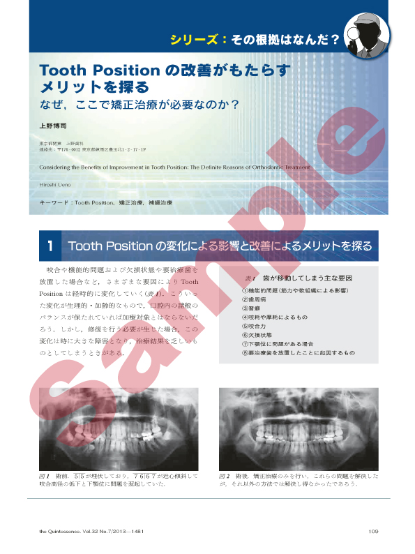 シリーズ：その根拠はなんだ？Tooth Positionの改善がもたらすメリットを探るなぜ，ここで矯正治療が必要なのか？ - クインテッセンス出版